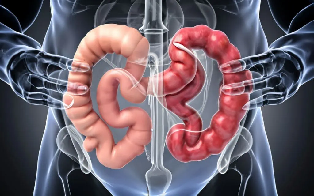 When Would You Need a Proctologist vs Gastroenterologist? When Would You Need a Proctologist vs Gastroenterologist?